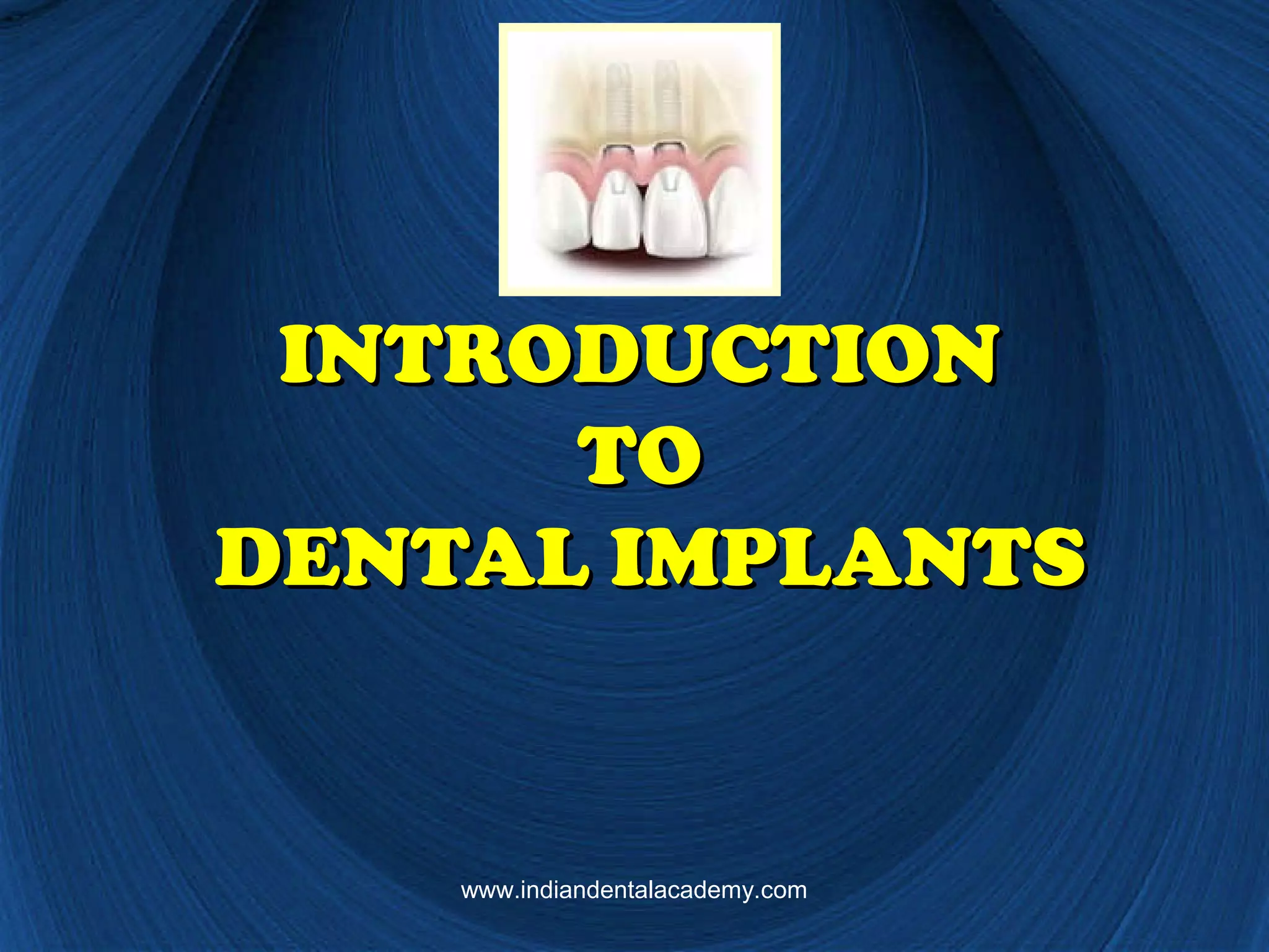 Introduction to dental implants / online orthodontic courses | PPT