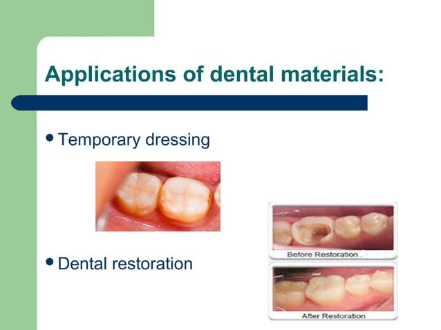 Introduction to dental materials 2 | PPT