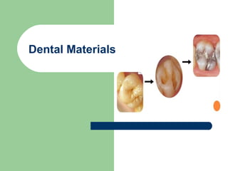 Introduction to dental materials 2 | PPT