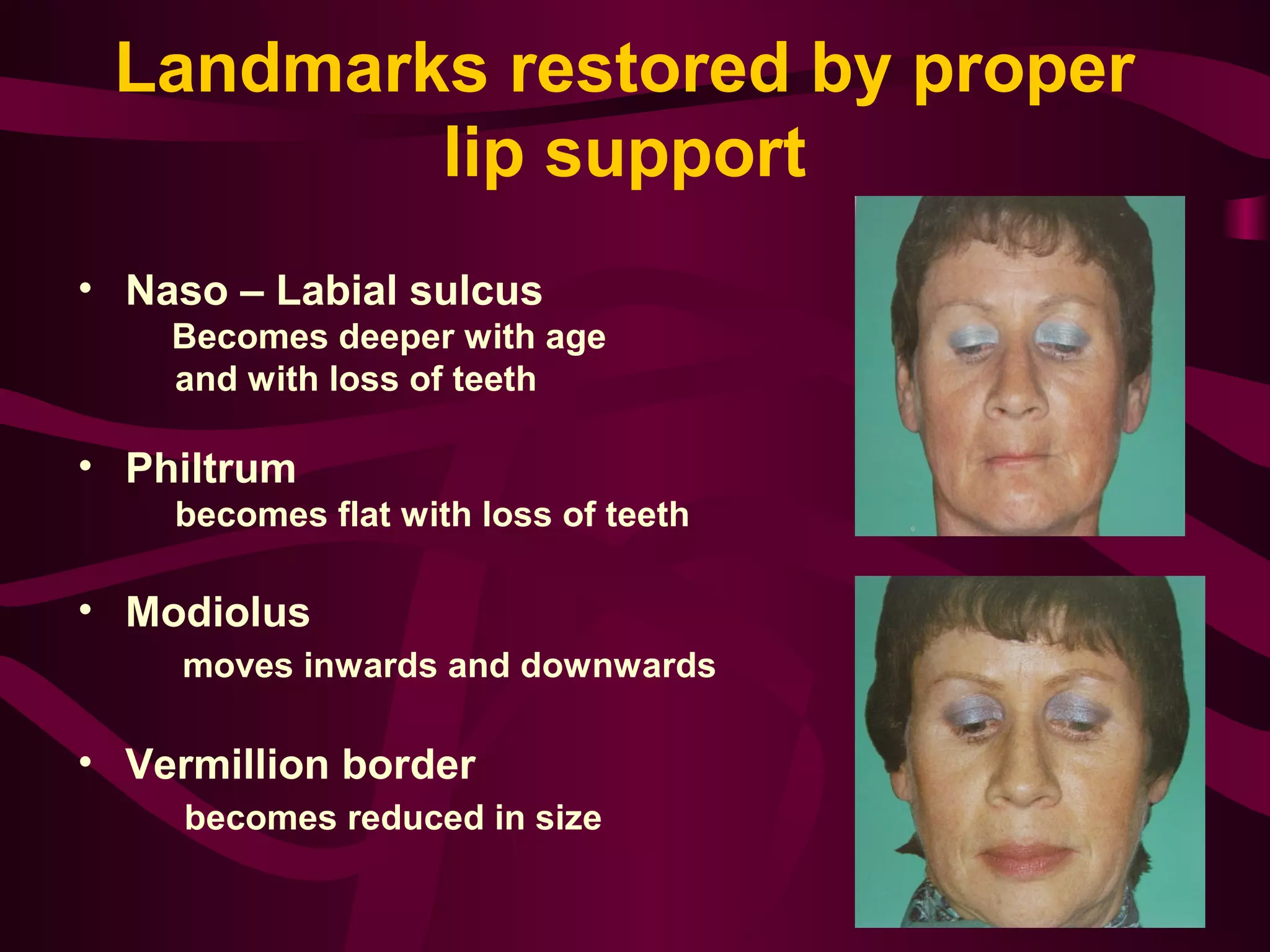 Introduction to prosthodontics | PPT