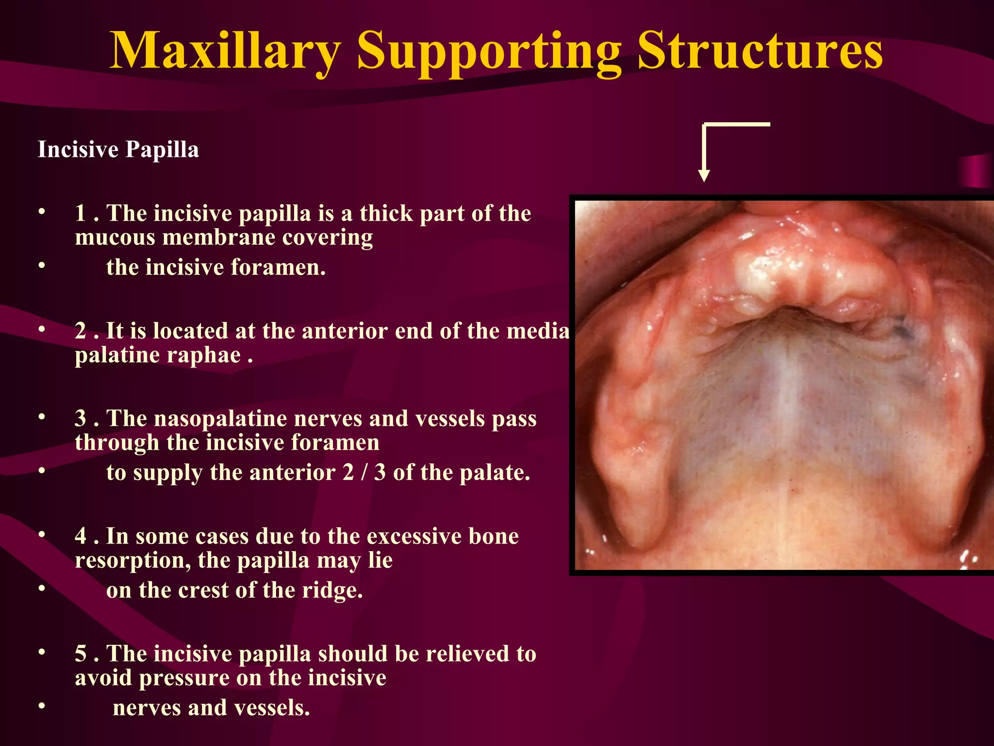 Introduction to prosthodontics | PPT