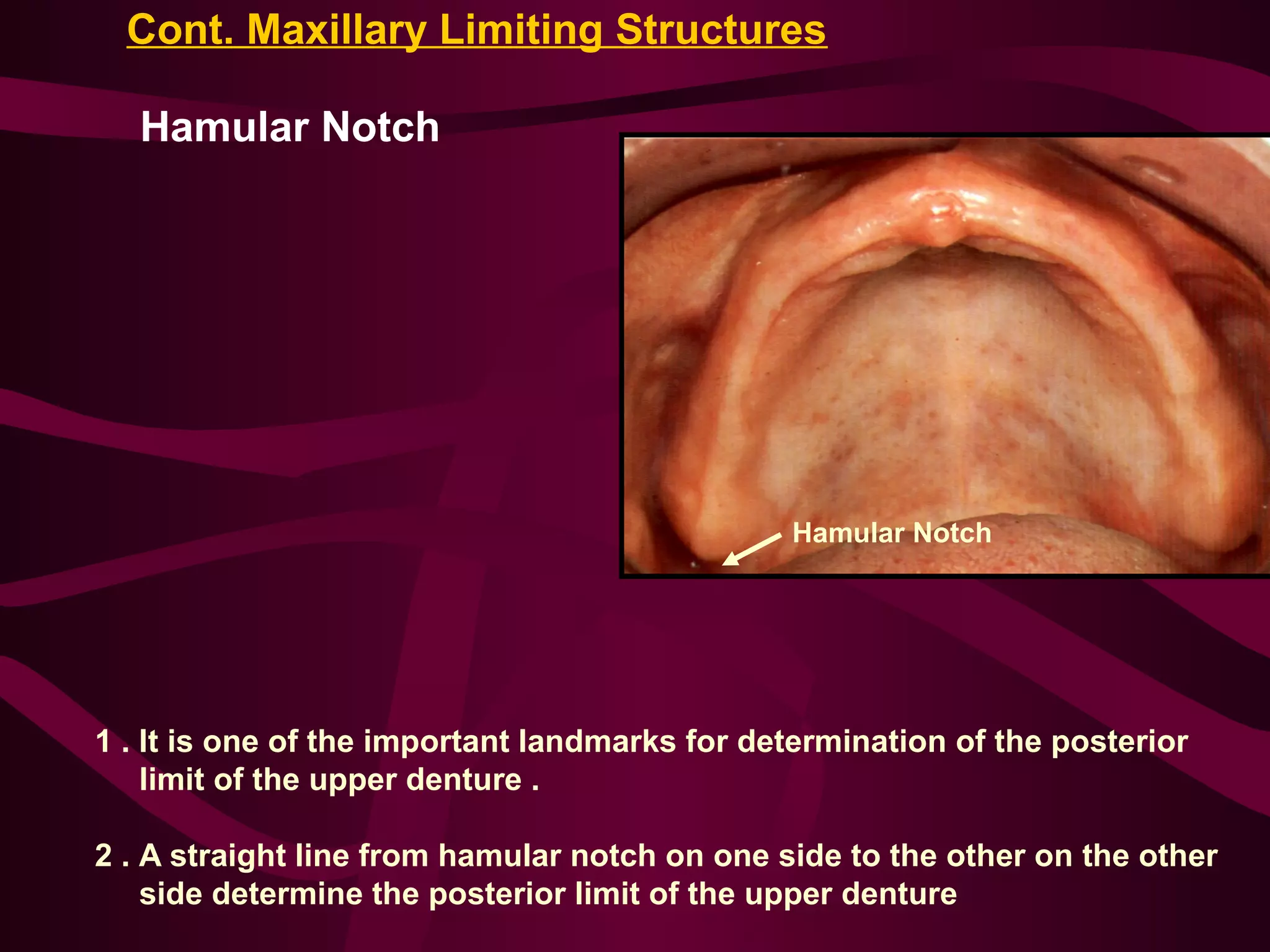 Introduction to prosthodontics | PPT