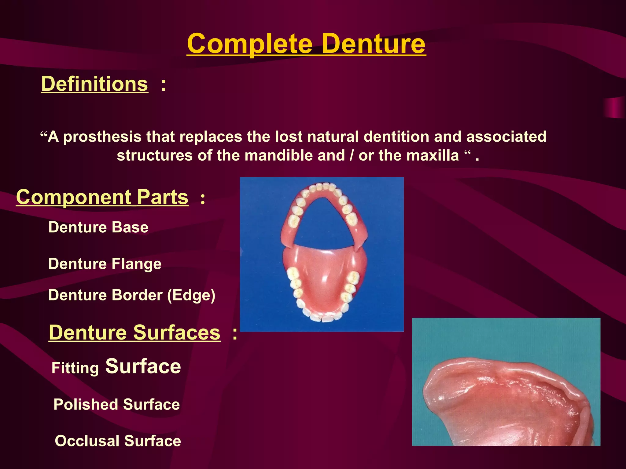 Introduction to prosthodontics | PPT