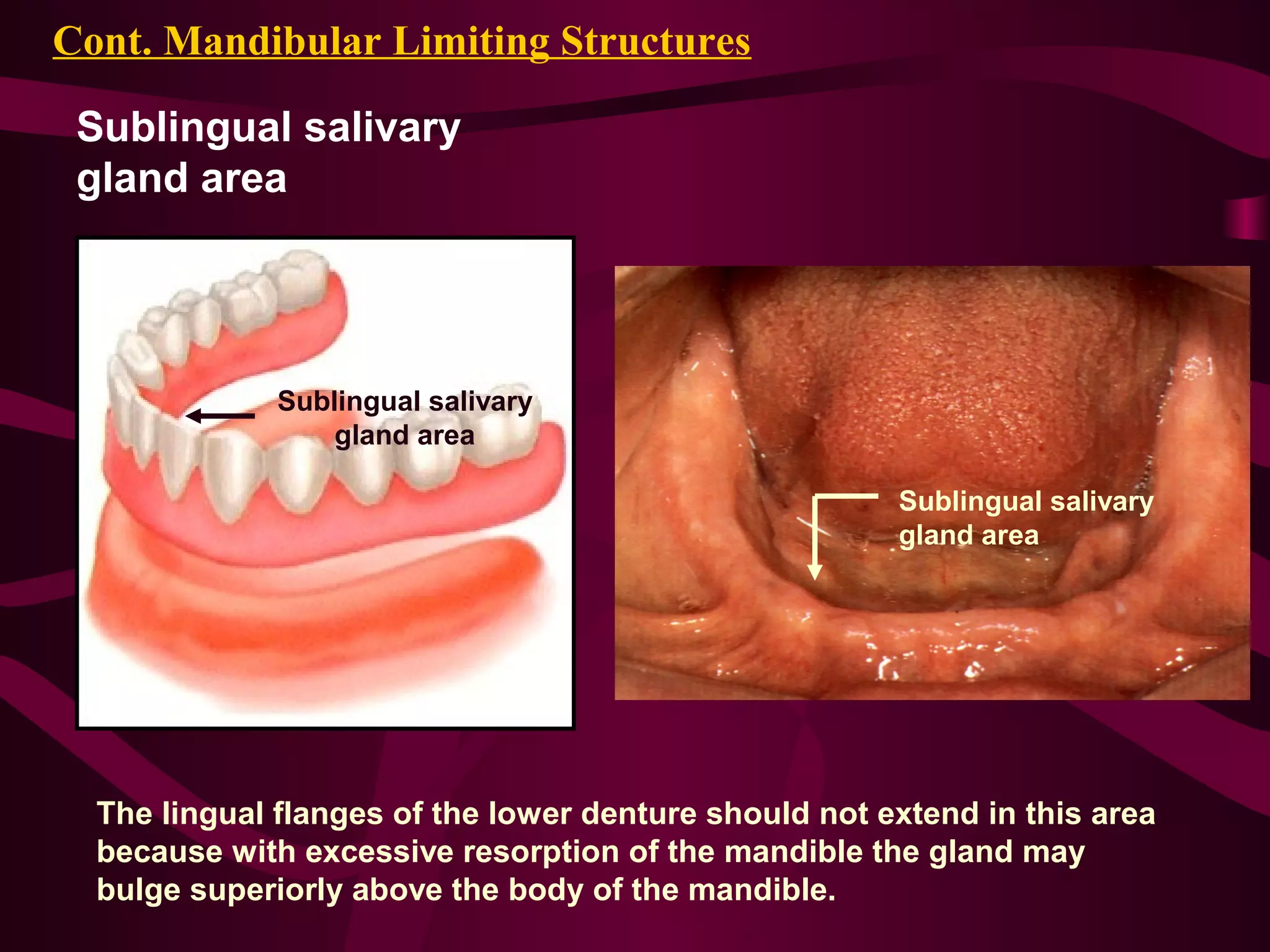 Introduction to prosthodontics | PPT