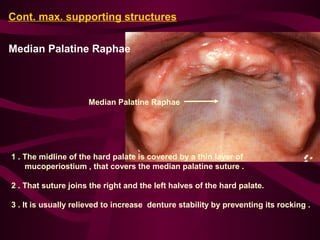 Introduction to prosthodontics | PPT