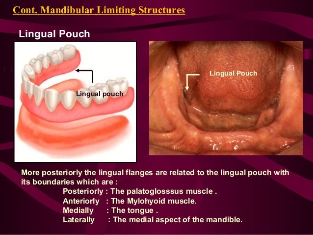 Introduction to prosthodontics
