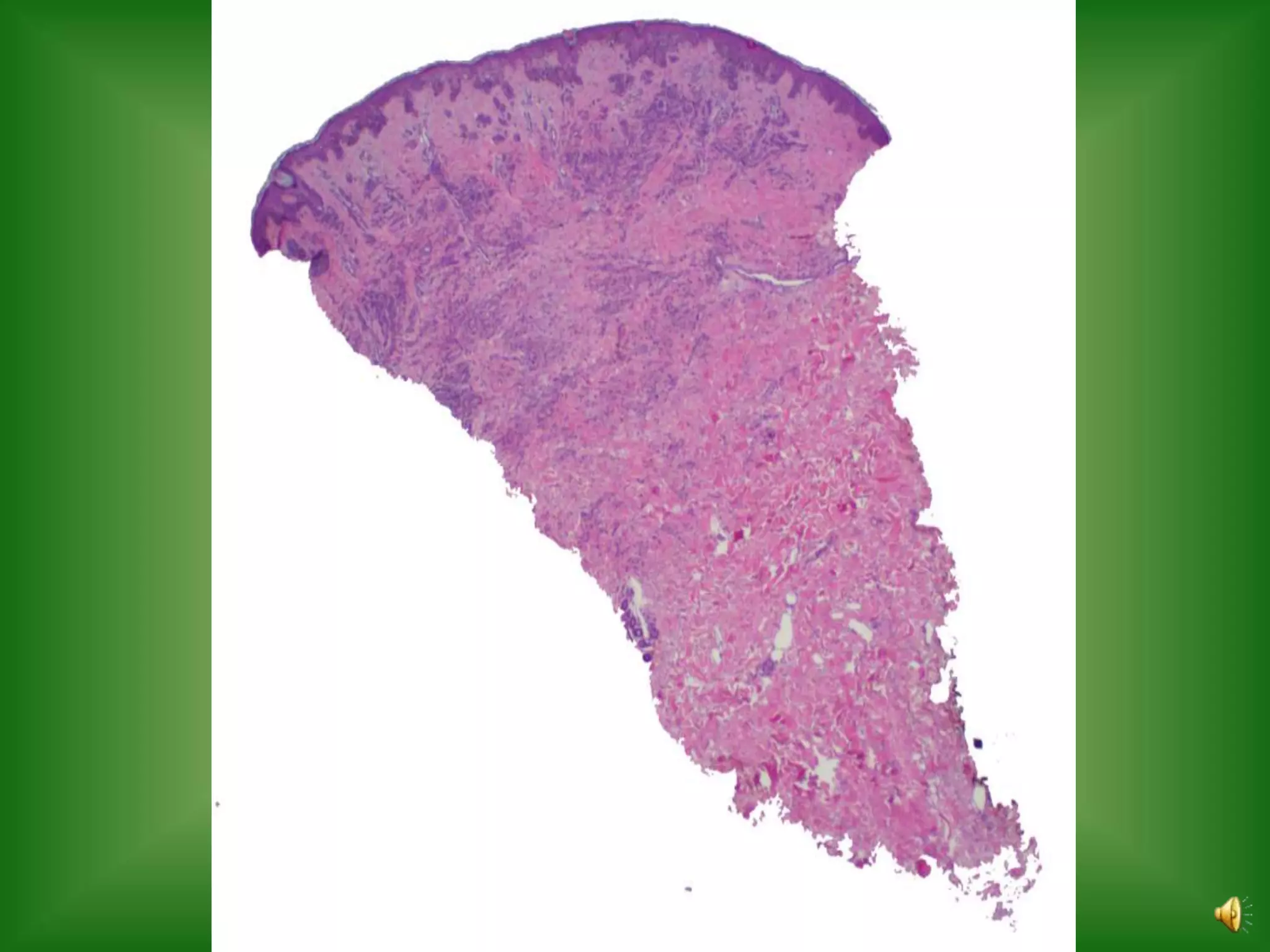 Introduction to dermatopathology | PPTX