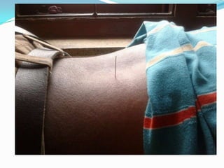 Introduction to dry needling | PPTX