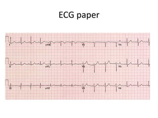 Introduction to ecg | PPTX