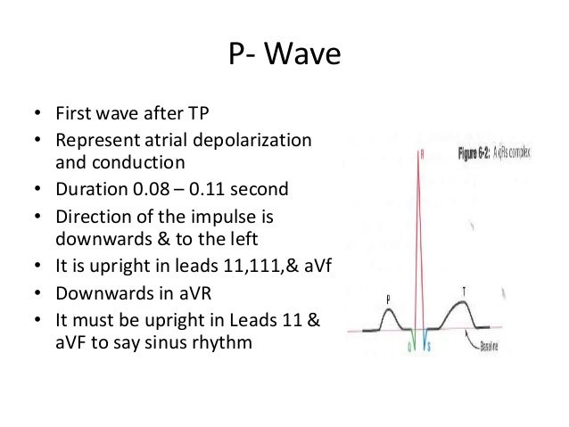 Introduction to ecg