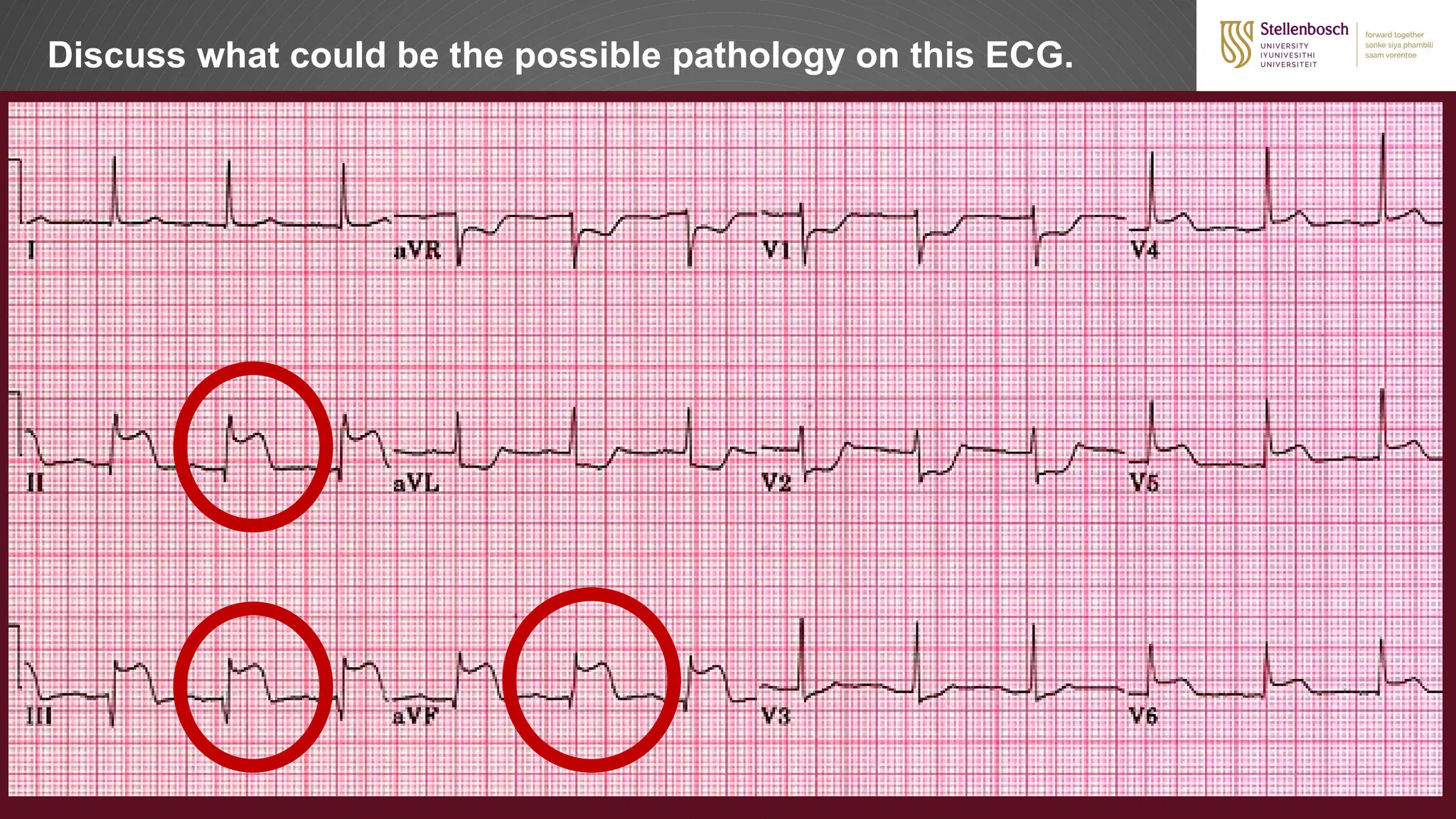 INTRODUCTION TO ECG (ELECTROCARDIOGRAM) EKG | PPTX