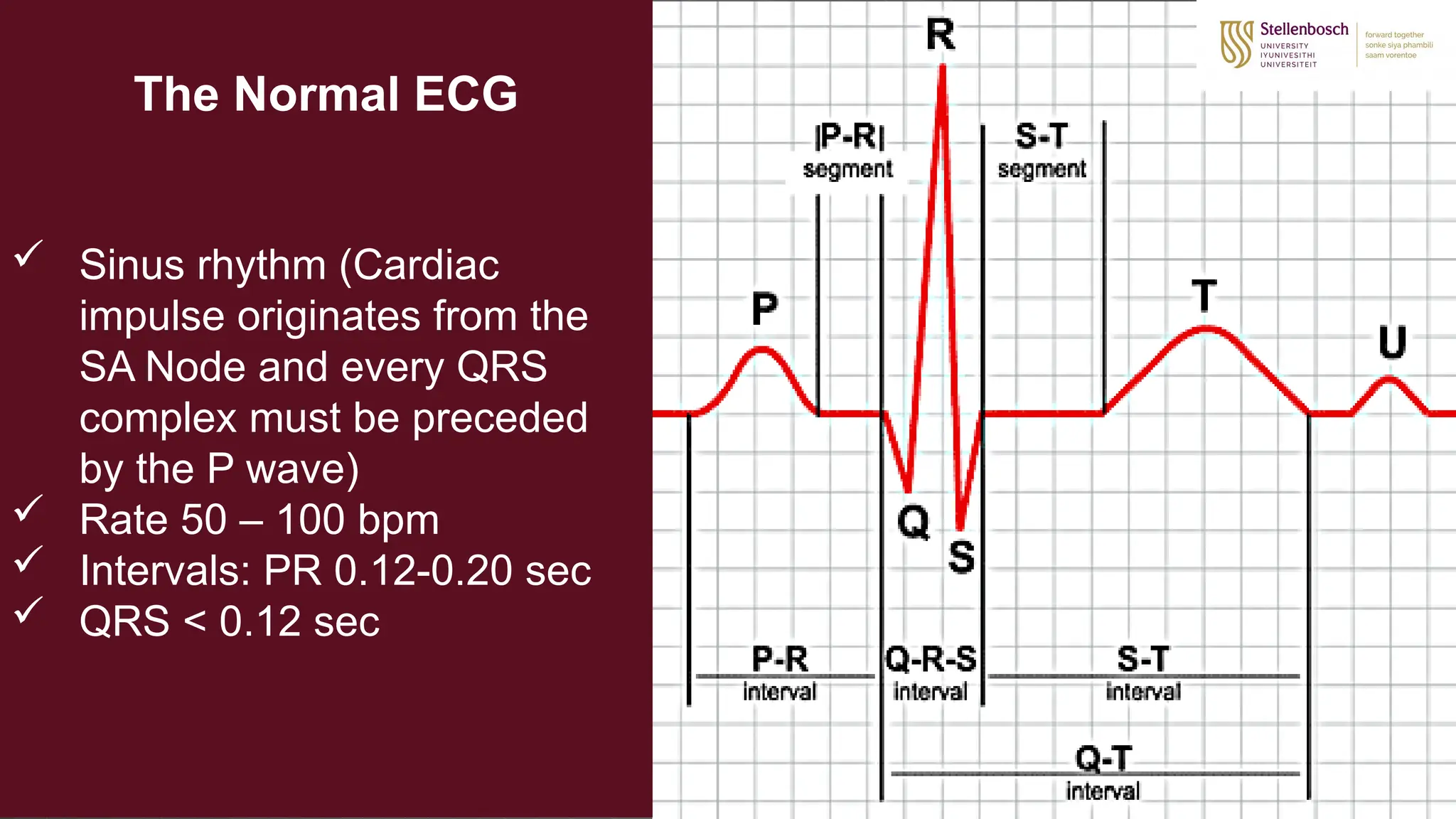 INTRODUCTION TO ECG (ELECTROCARDIOGRAM) EKG | PPTX
