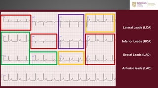 INTRODUCTION TO ECG (ELECTROCARDIOGRAM) EKG | PPTX