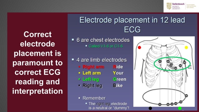 INTRODUCTION TO ECG (ELECTROCARDIOGRAM) EKG | PPTX