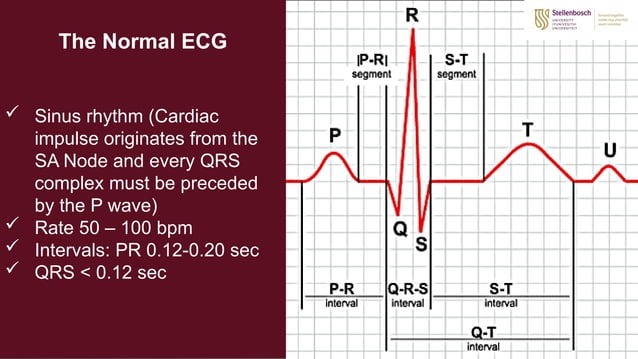 INTRODUCTION TO ECG (ELECTROCARDIOGRAM) EKG | PPTX