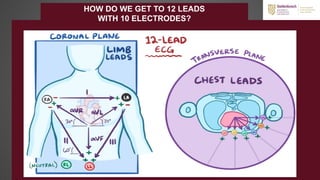 INTRODUCTION TO ECG (ELECTROCARDIOGRAM) EKG | PPTX