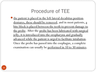 Introduction to echocardiography | PPT
