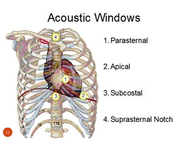 Introduction to echocardiography
