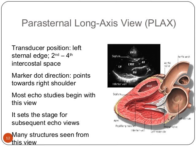 Introduction to echocardiography