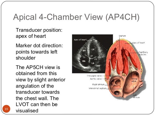 Introduction to echocardiography