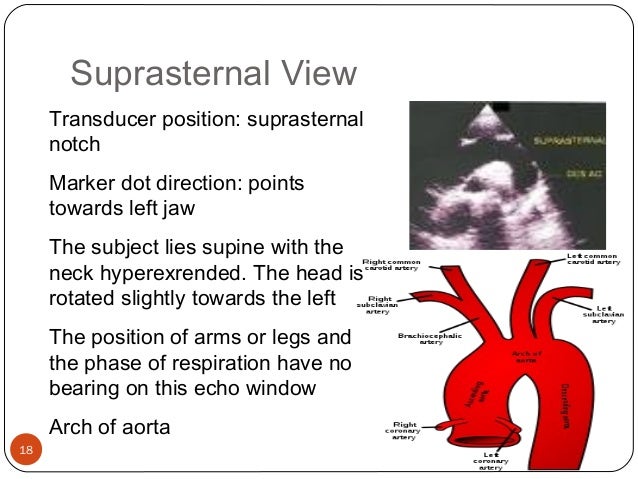 Introduction to echocardiography