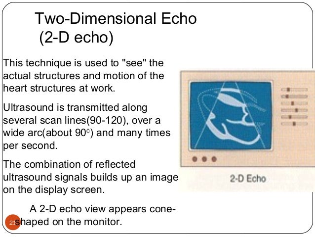 Introduction to echocardiography