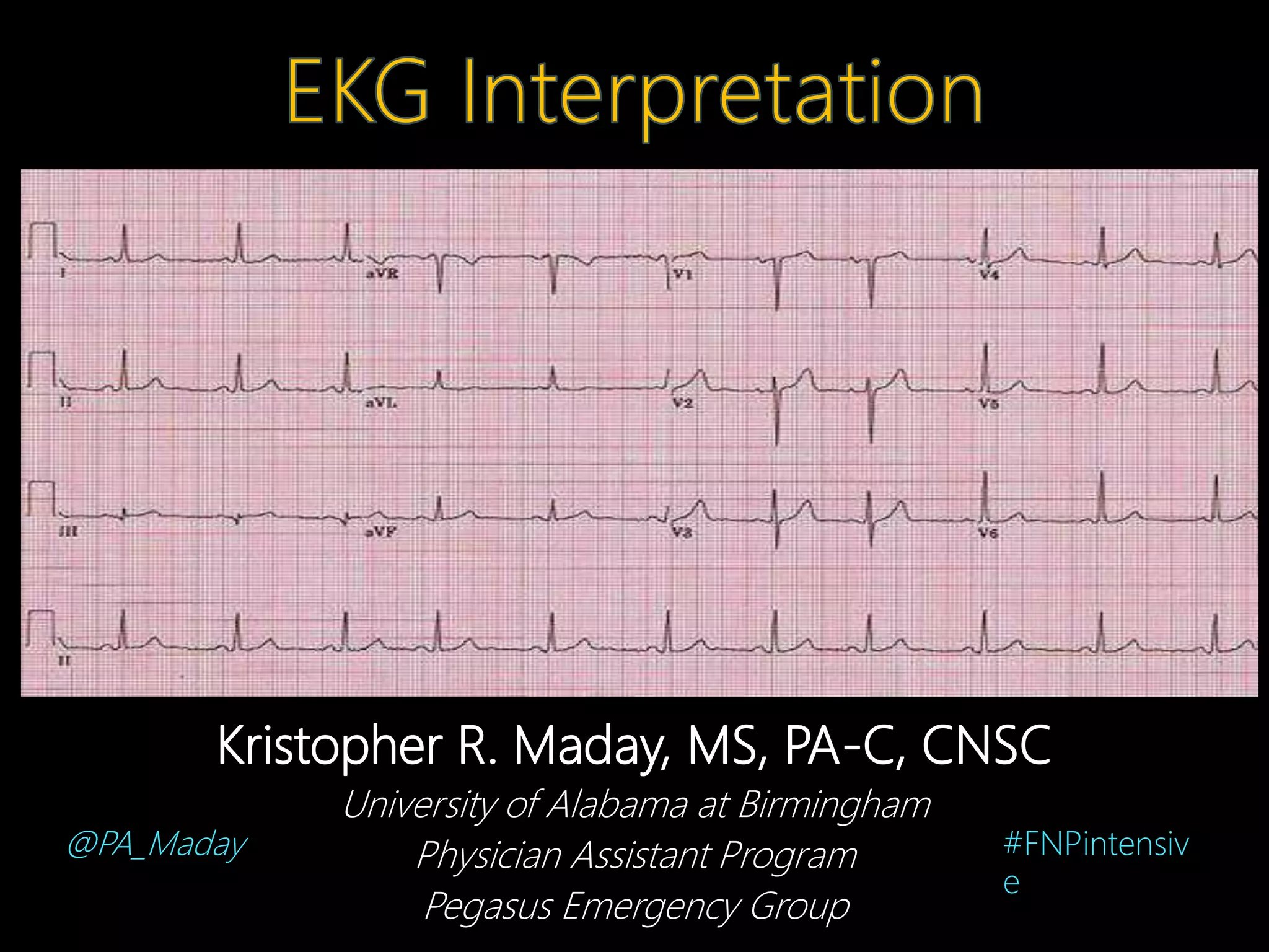 Introduction to EKG Interpretation | PPT