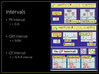 Introduction to EKG Interpretation | PPTX