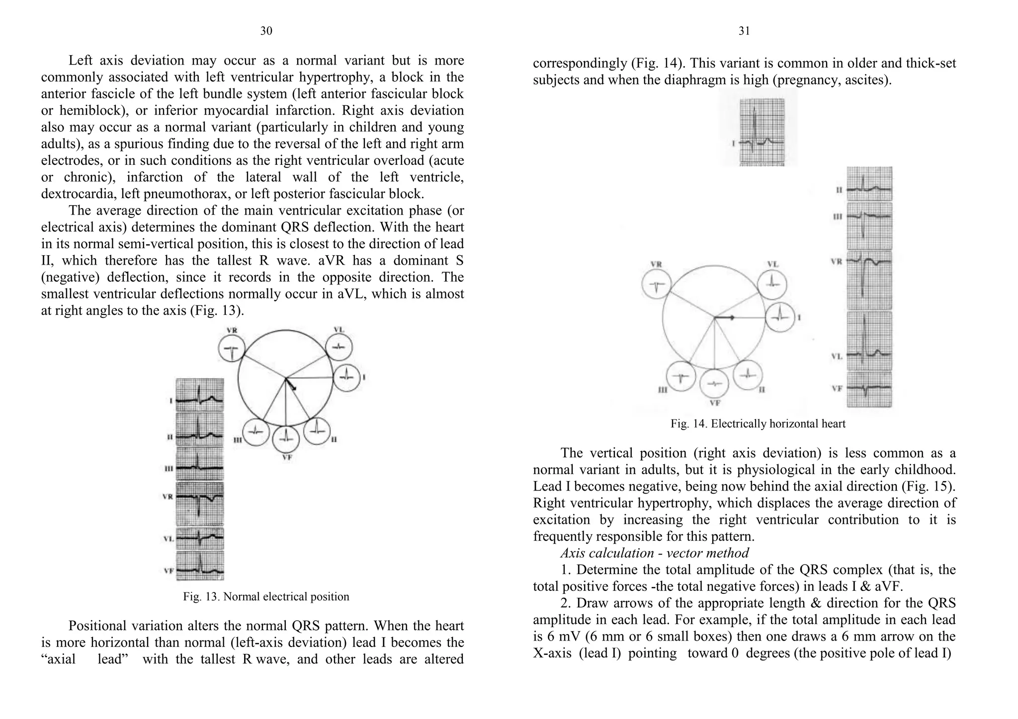 Introduction to Electrocariography(ecg).doc
