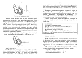 Introduction to Electrocariography(ecg).doc