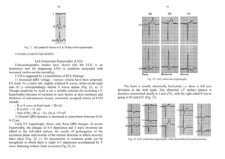 Introduction to Electrocariography(ecg).doc