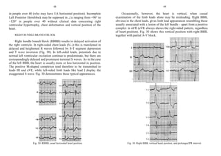 Introduction to Electrocariography(ecg).doc