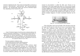 Introduction to Electrocariography(ecg).doc