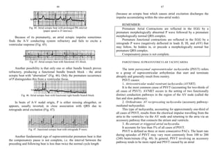 Introduction to Electrocariography(ecg).doc