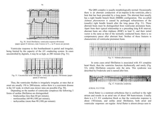 Introduction to Electrocariography(ecg).doc