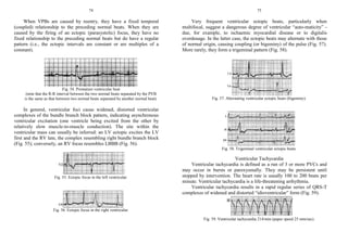 Introduction to Electrocariography(ecg).doc
