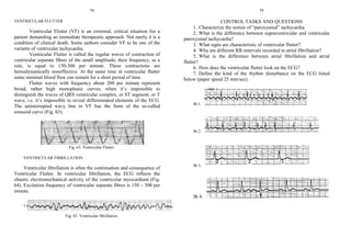 Introduction to Electrocariography(ecg).doc