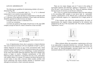 Introduction to Electrocariography(ecg).doc
