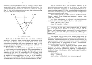 Introduction to Electrocariography(ecg).doc