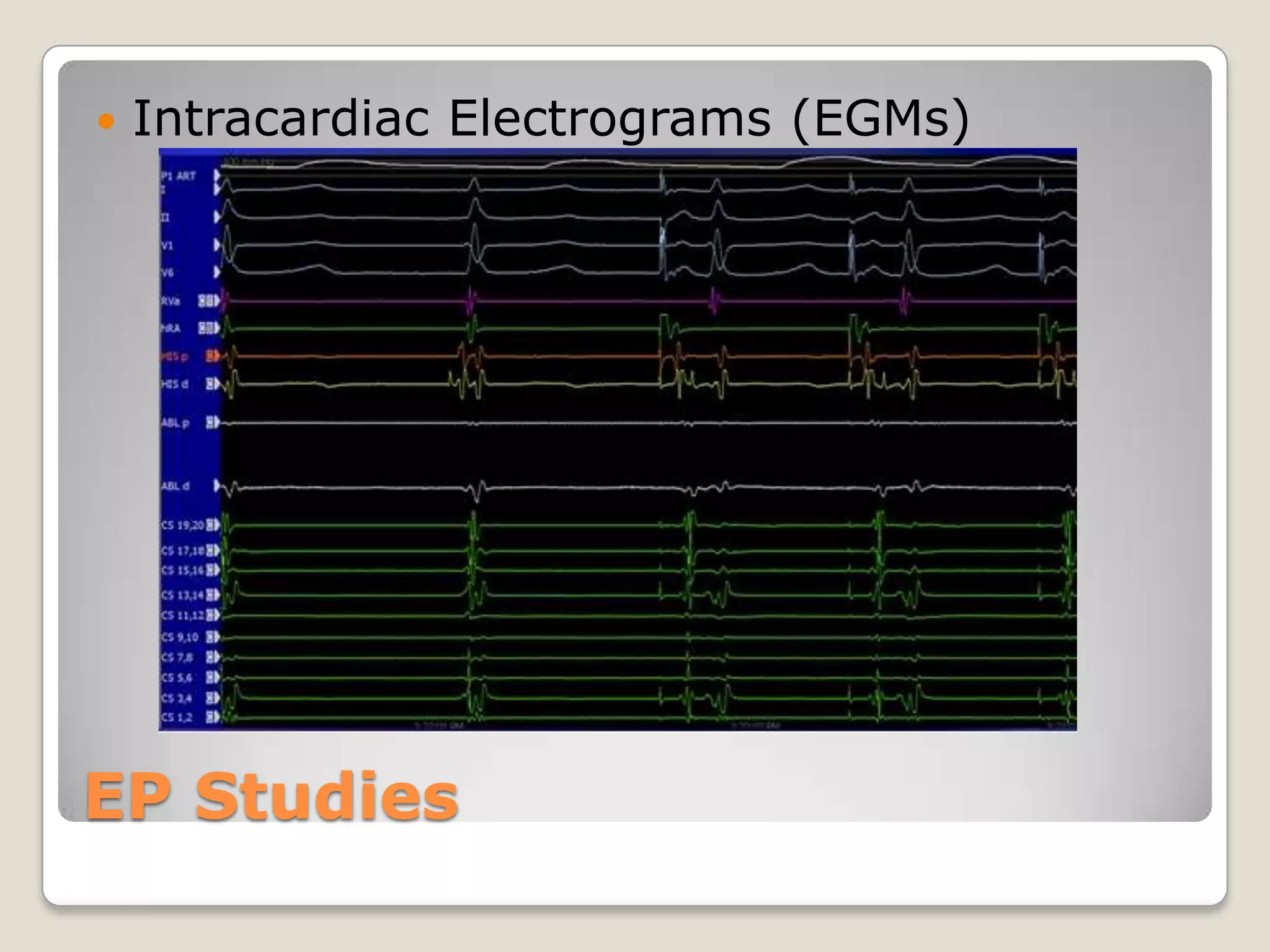 Introduction To Electrophysiology | PPTX