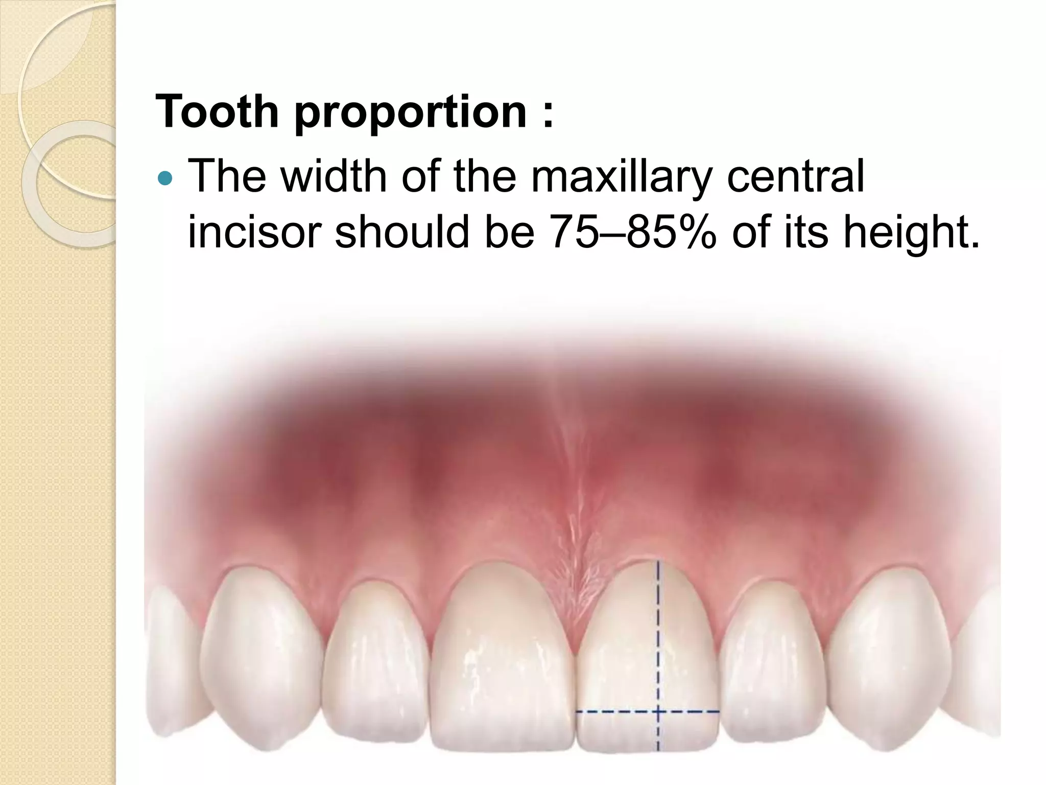 Introduction to esthetic dentistry | PPTX