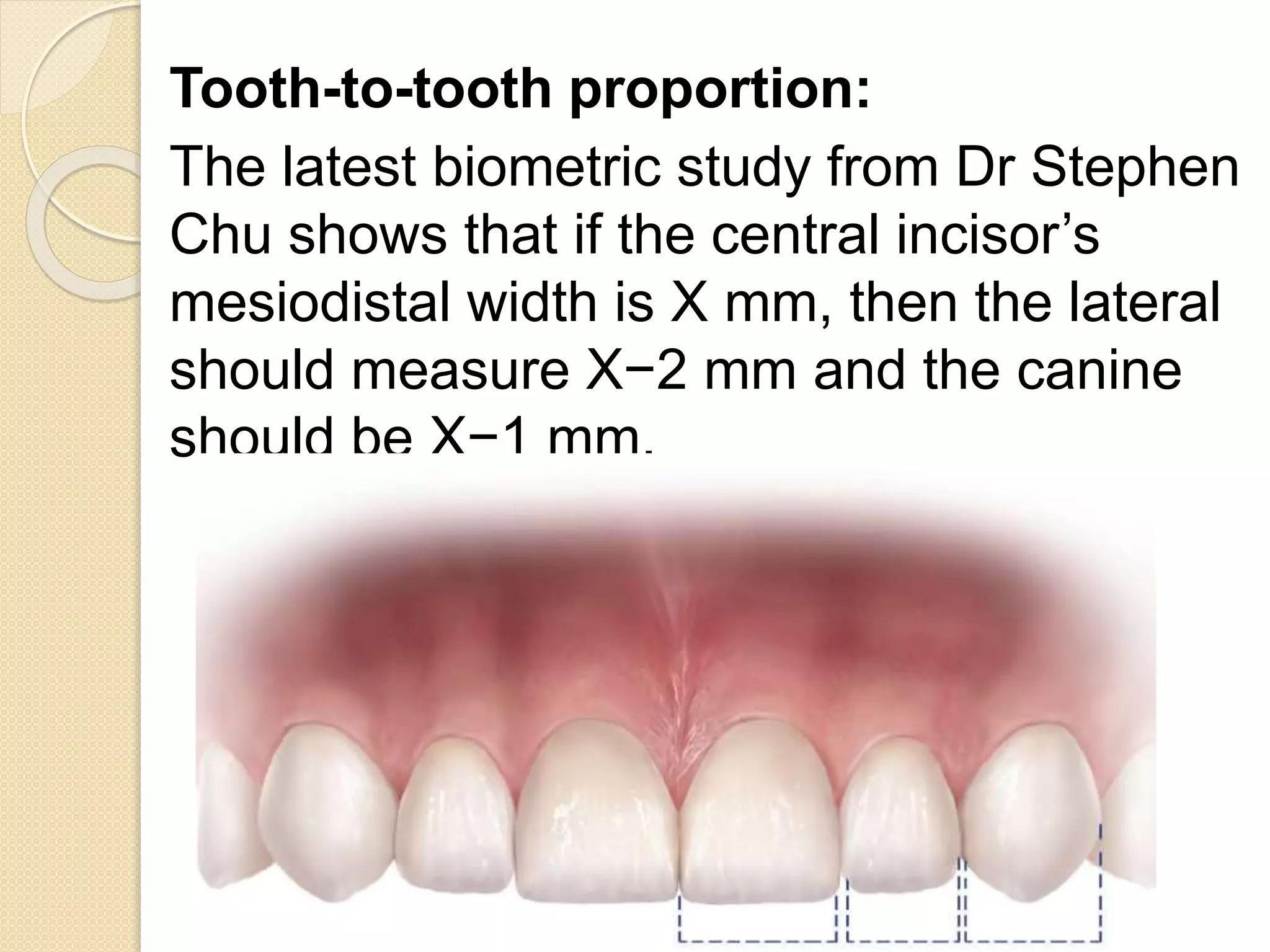 Introduction to esthetic dentistry | PPTX