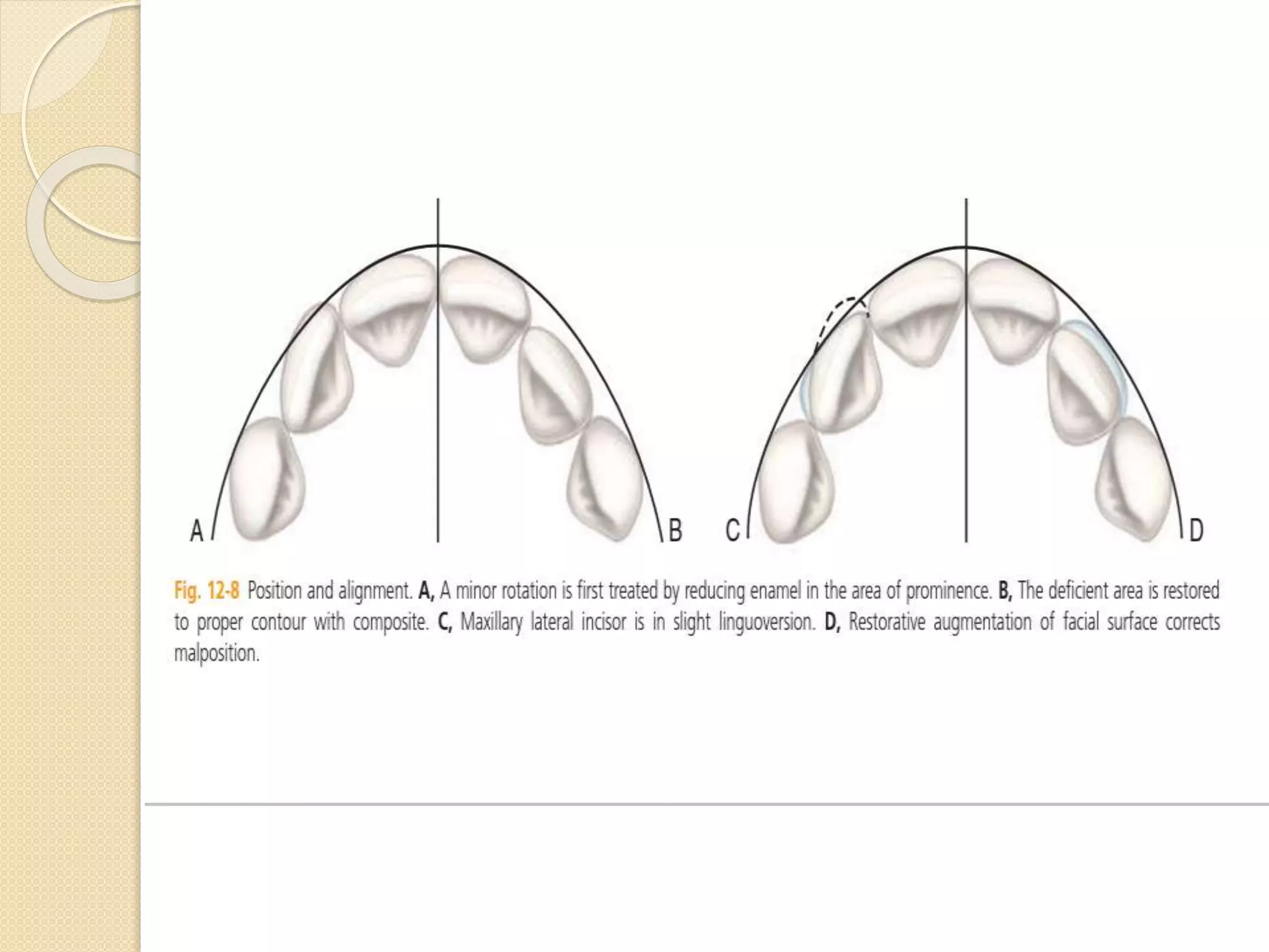 Introduction to esthetic dentistry | PPTX