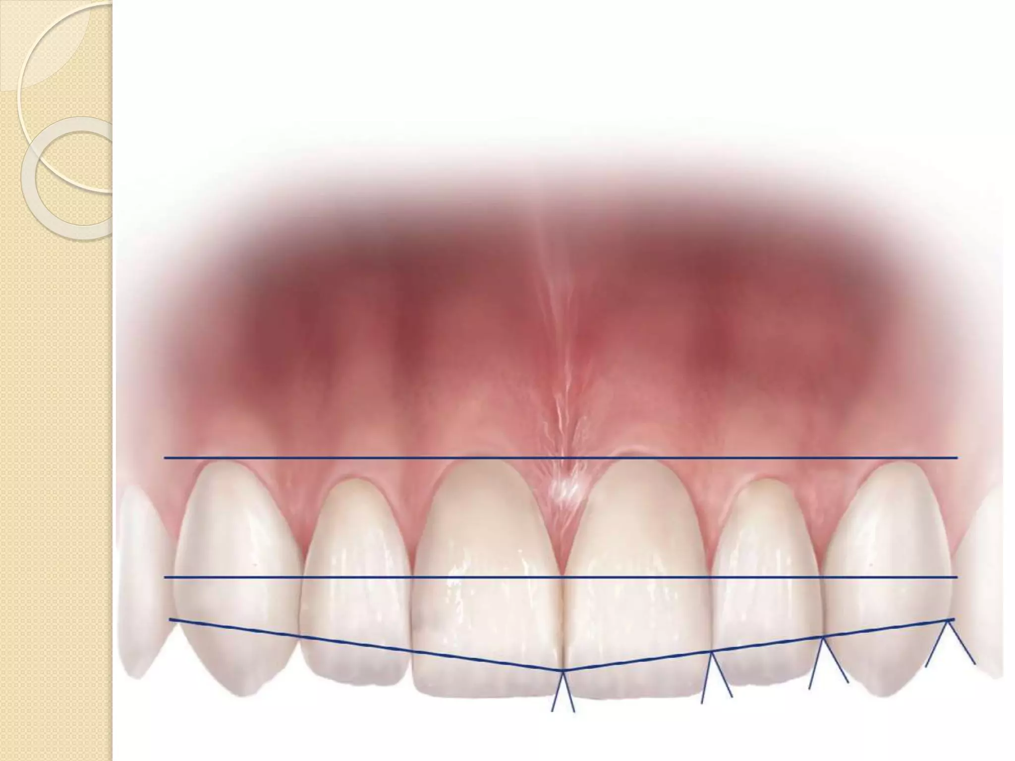 Introduction to esthetic dentistry | PPTX