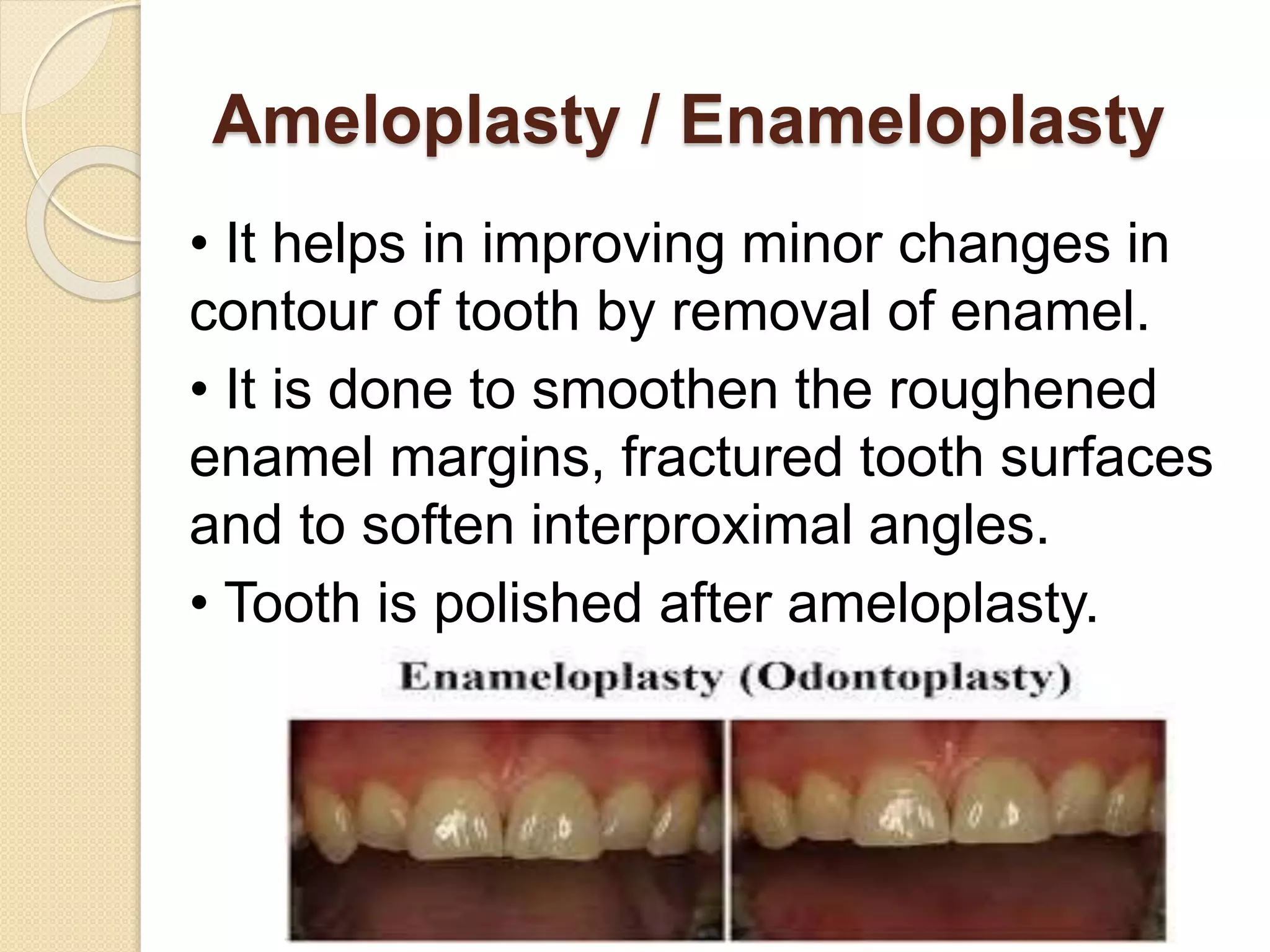 Introduction to esthetic dentistry | PPTX