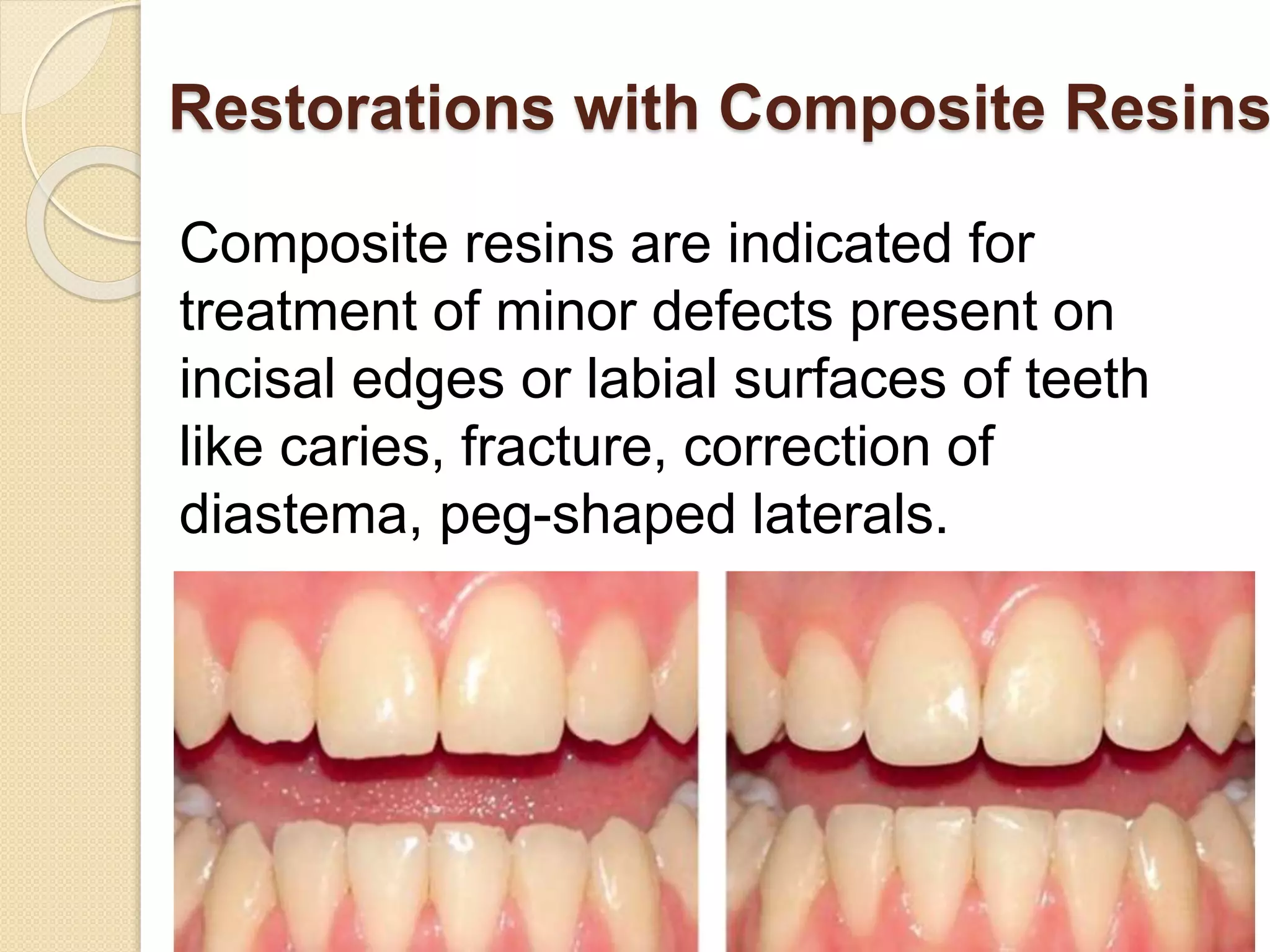 Introduction to esthetic dentistry | PPTX