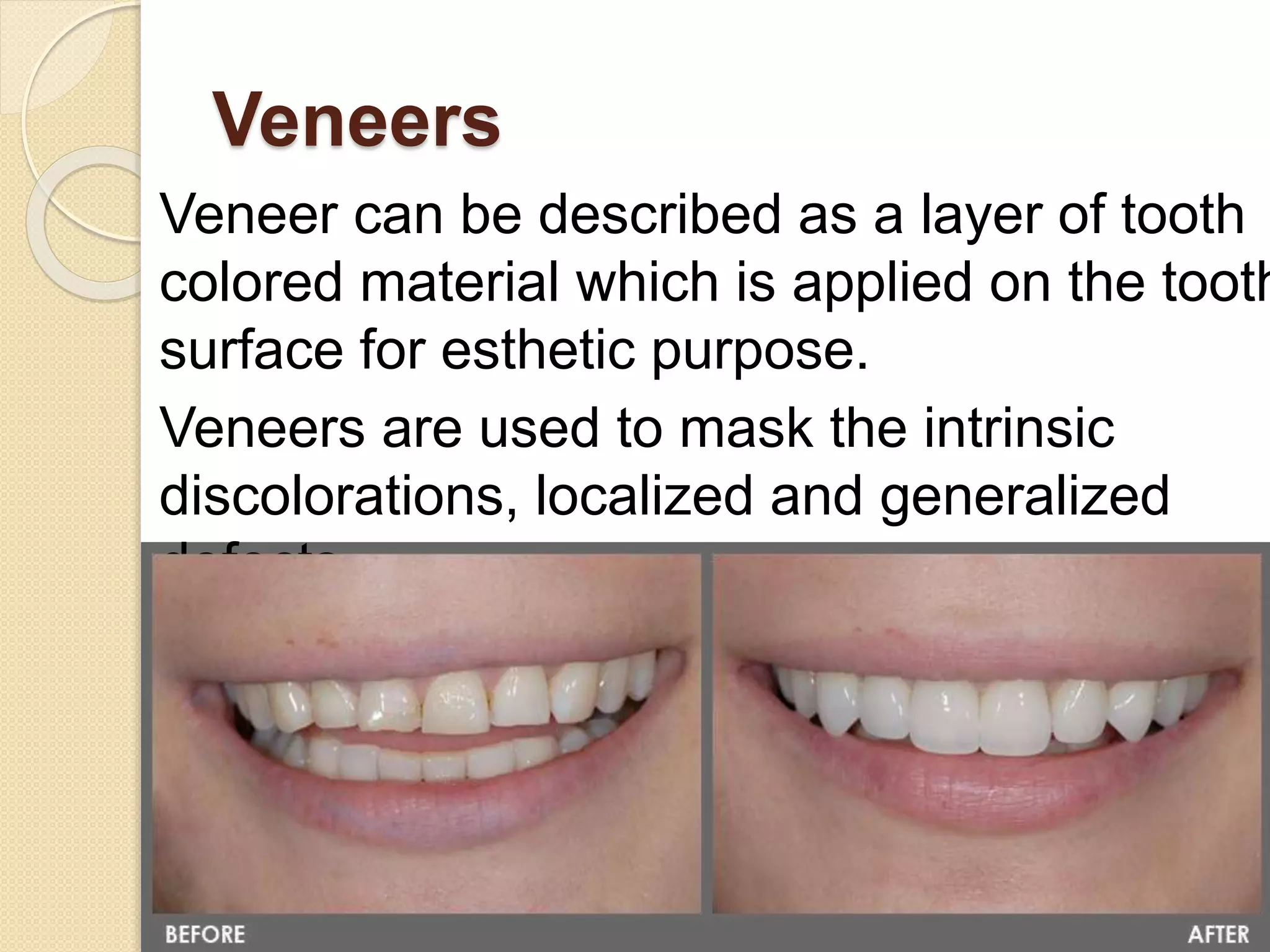 Introduction to esthetic dentistry | PPTX