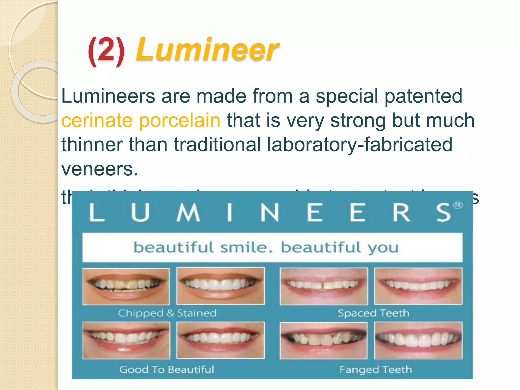Introduction to esthetic dentistry | PPTX