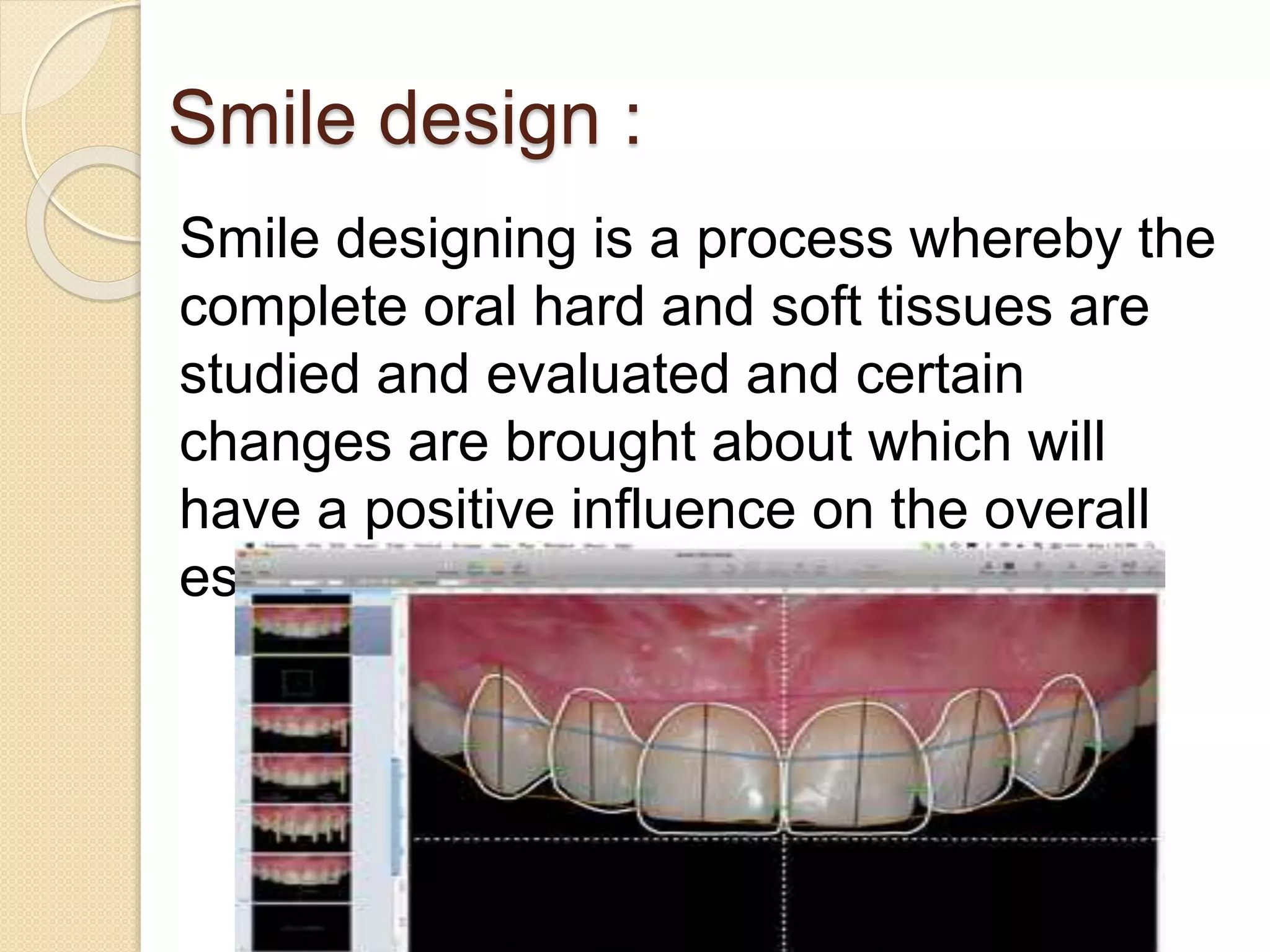 Introduction to esthetic dentistry | PPTX