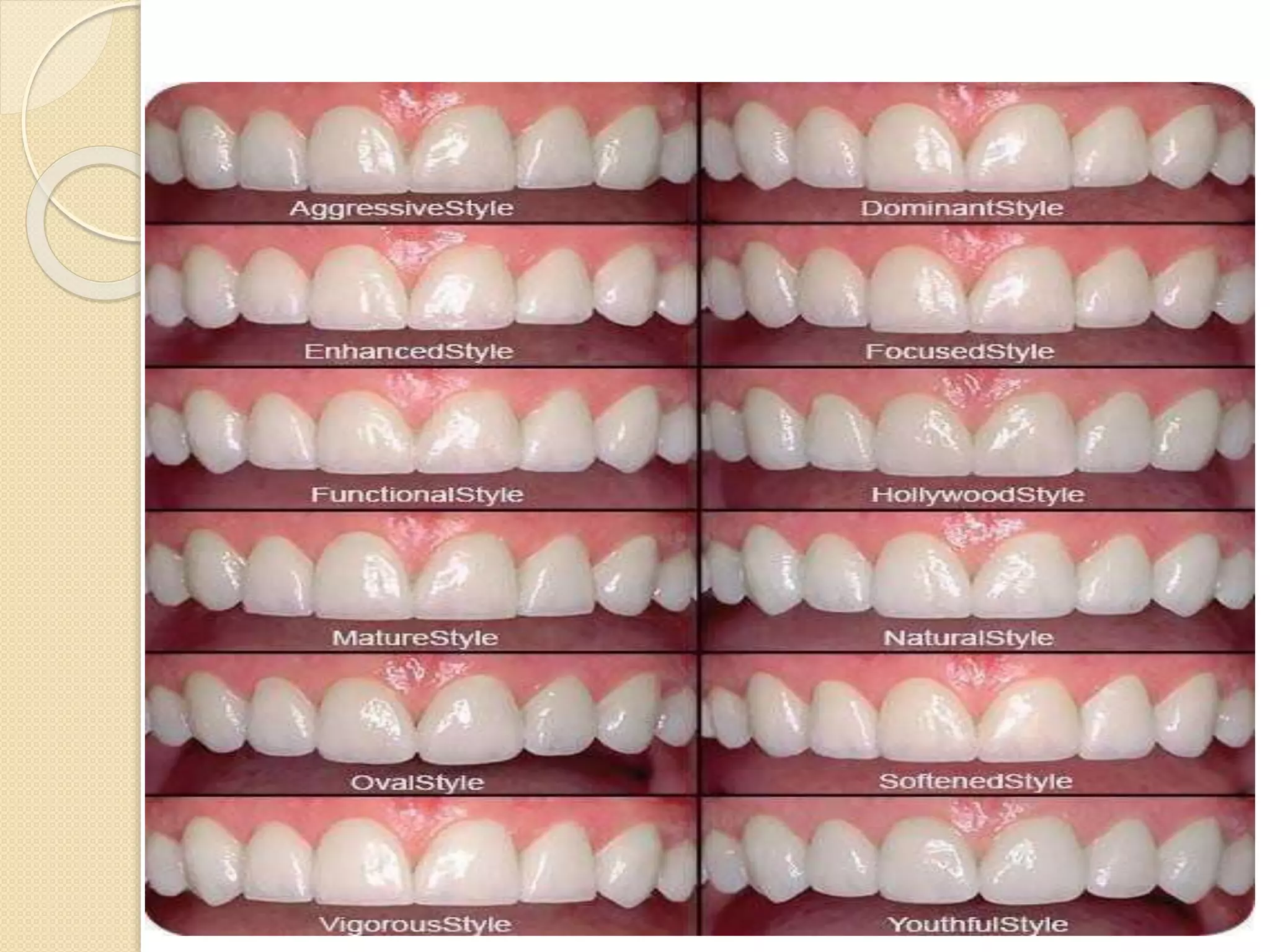Introduction to esthetic dentistry | PPTX